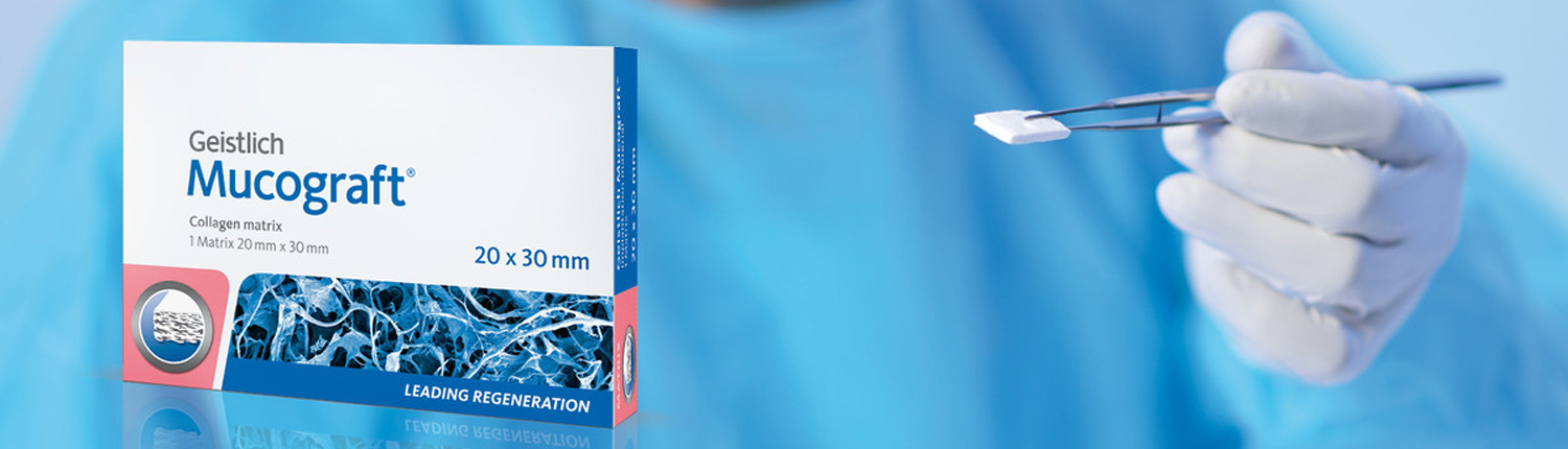 Geistlich Mucograft® » Dentalmax SA