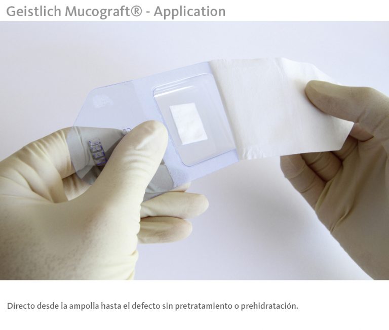 Geistlich Mucograft® – Dentalmax SA
